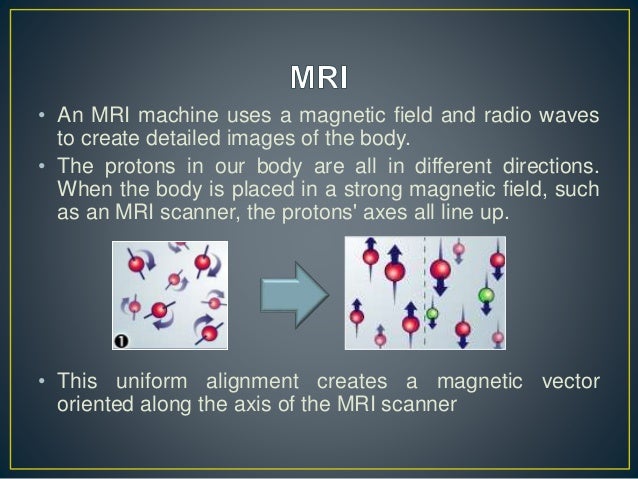 MRI