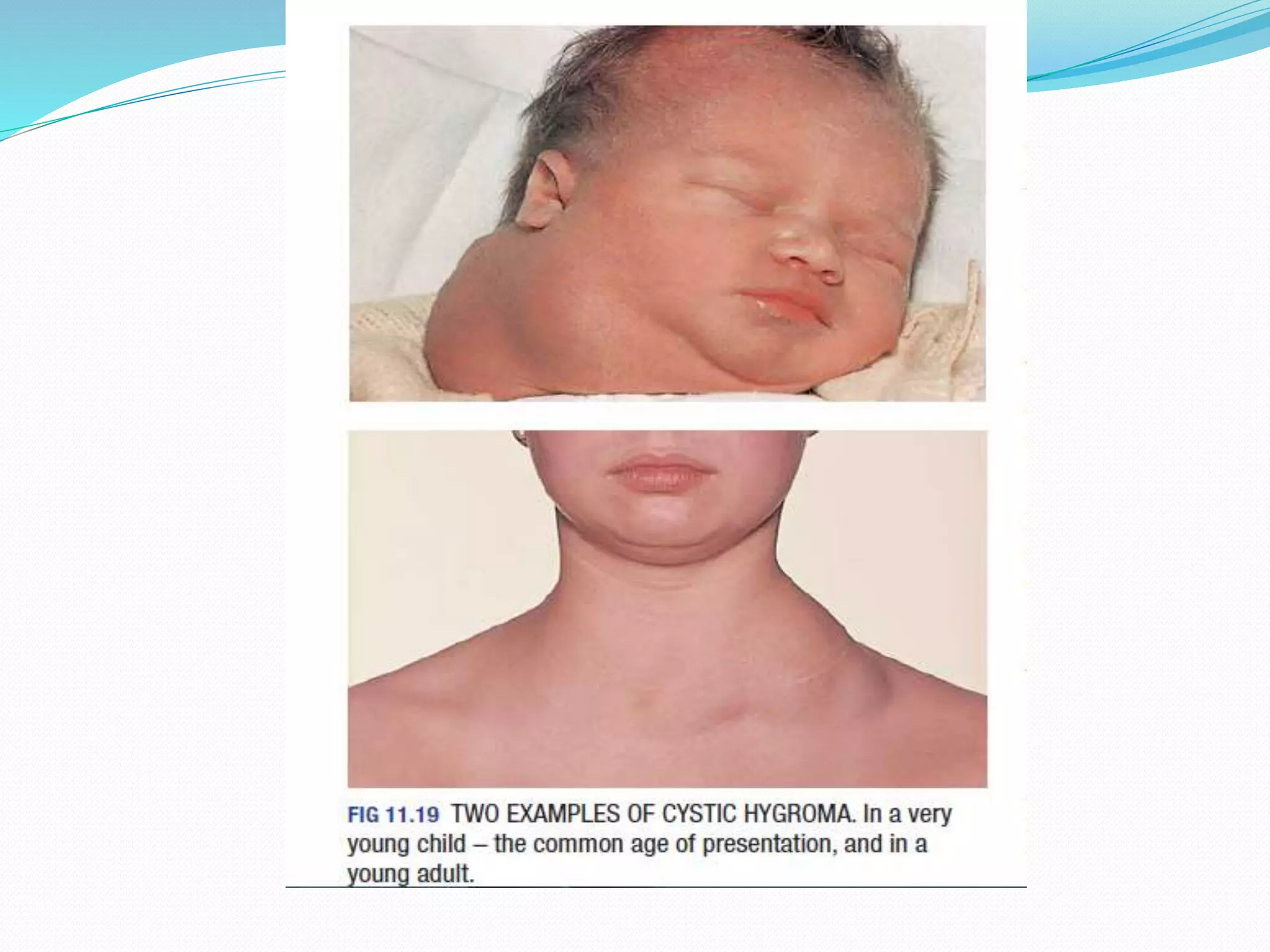 6-Neck swelling.pptx