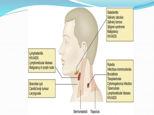 6-Neck swelling.pptx