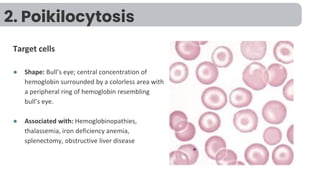 6 - Normal and Abnormal Red Blood Cells Morphology .pdf
