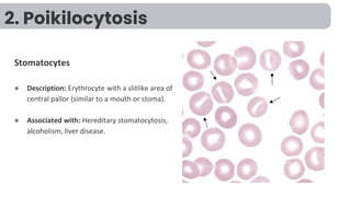 6 - Normal and Abnormal Red Blood Cells Morphology .pdf