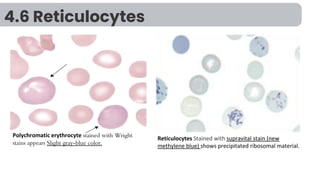 6 - Normal and Abnormal Red Blood Cells Morphology .pdf