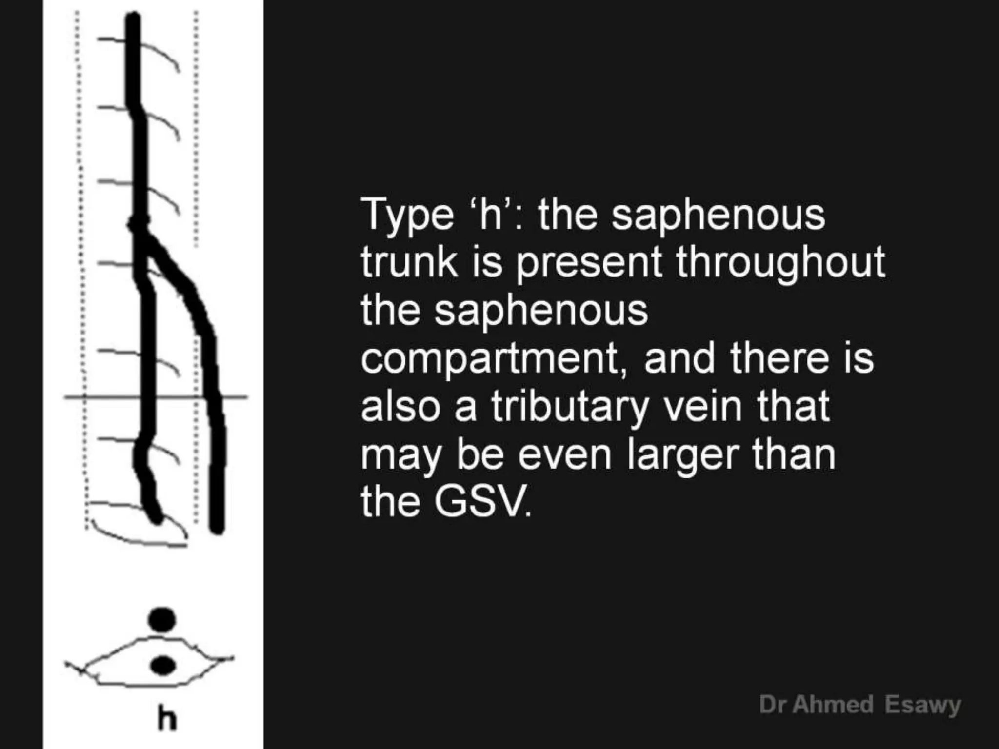 6 peripheral venous duplex superfiscial venous system in lower limb ...