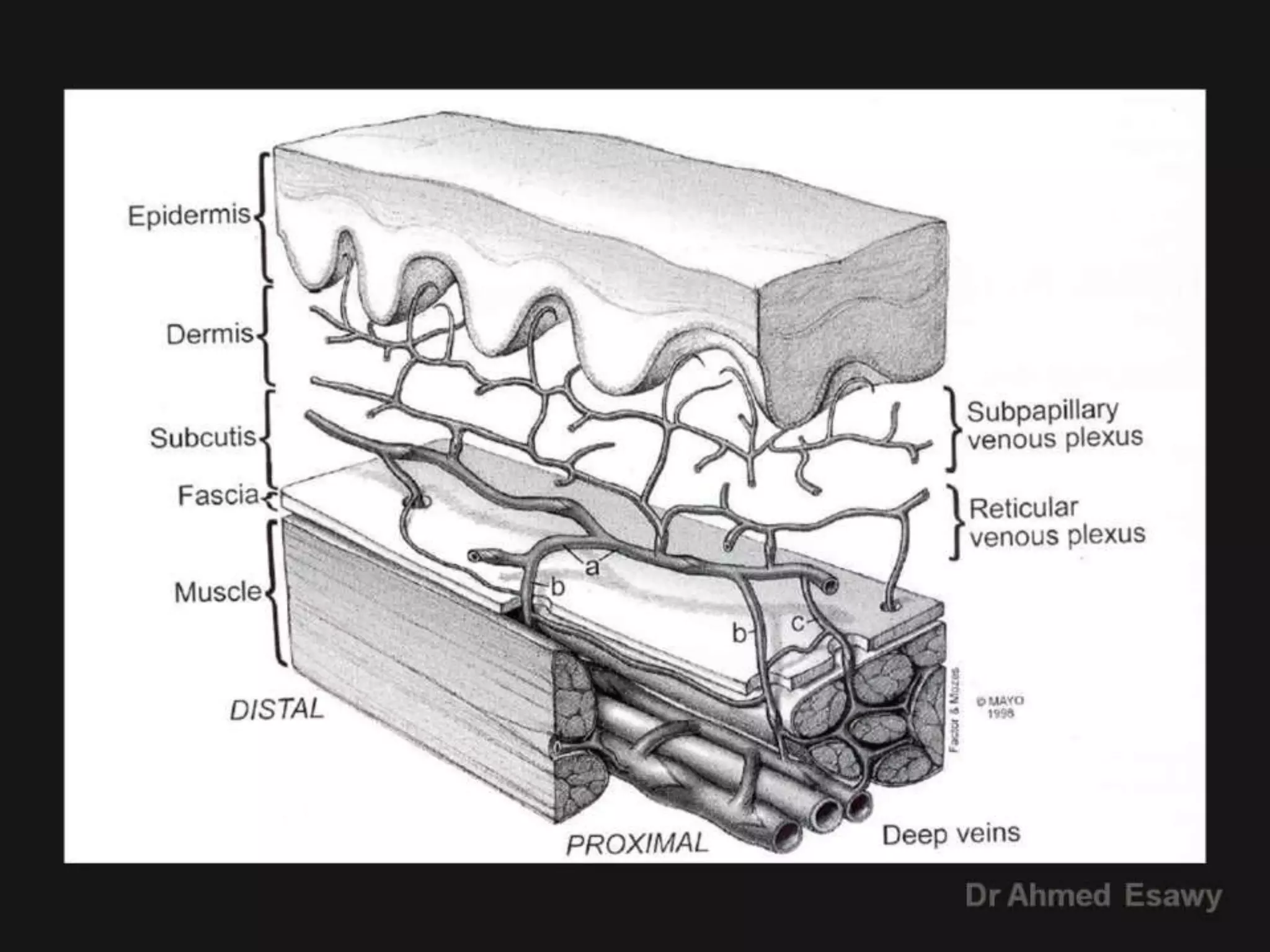 6 peripheral venous duplex superfiscial venous system in lower limb ...