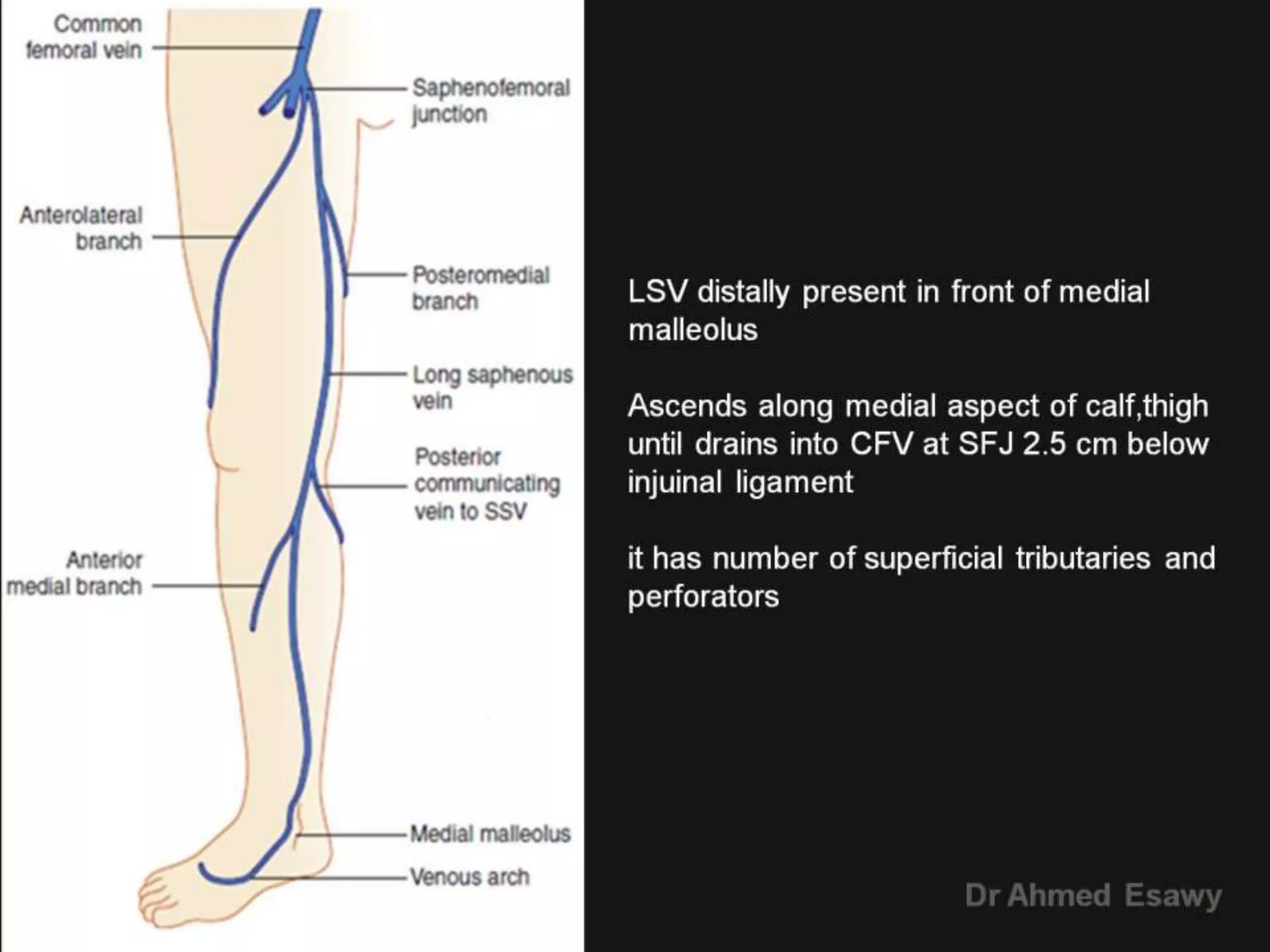 6 peripheral venous duplex superfiscial venous system in lower limb ...