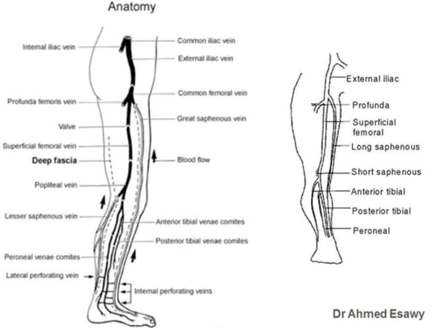 6 peripheral venous duplex superfiscial venous system in lower limb ...