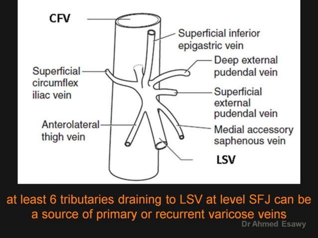 6 peripheral venous duplex superfiscial venous system in lower limb ...