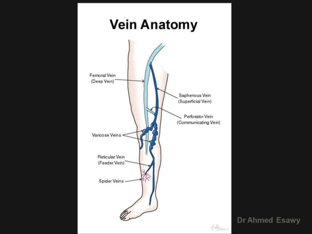 6 peripheral venous duplex superfiscial venous system in lower limb ...