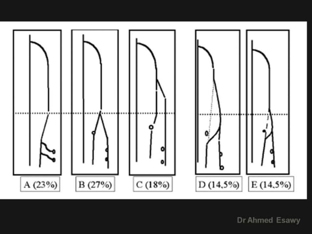 6 peripheral venous duplex superfiscial venous system in lower limb ...