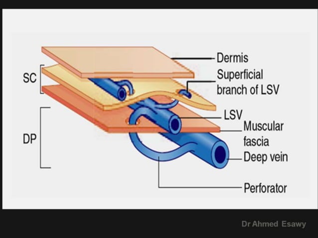 6 peripheral venous duplex superfiscial venous system in lower limb ...