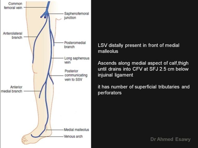 6 peripheral venous duplex superfiscial venous system in lower limb ...