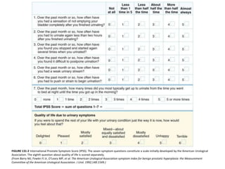 Prostate Cancer | PPTX