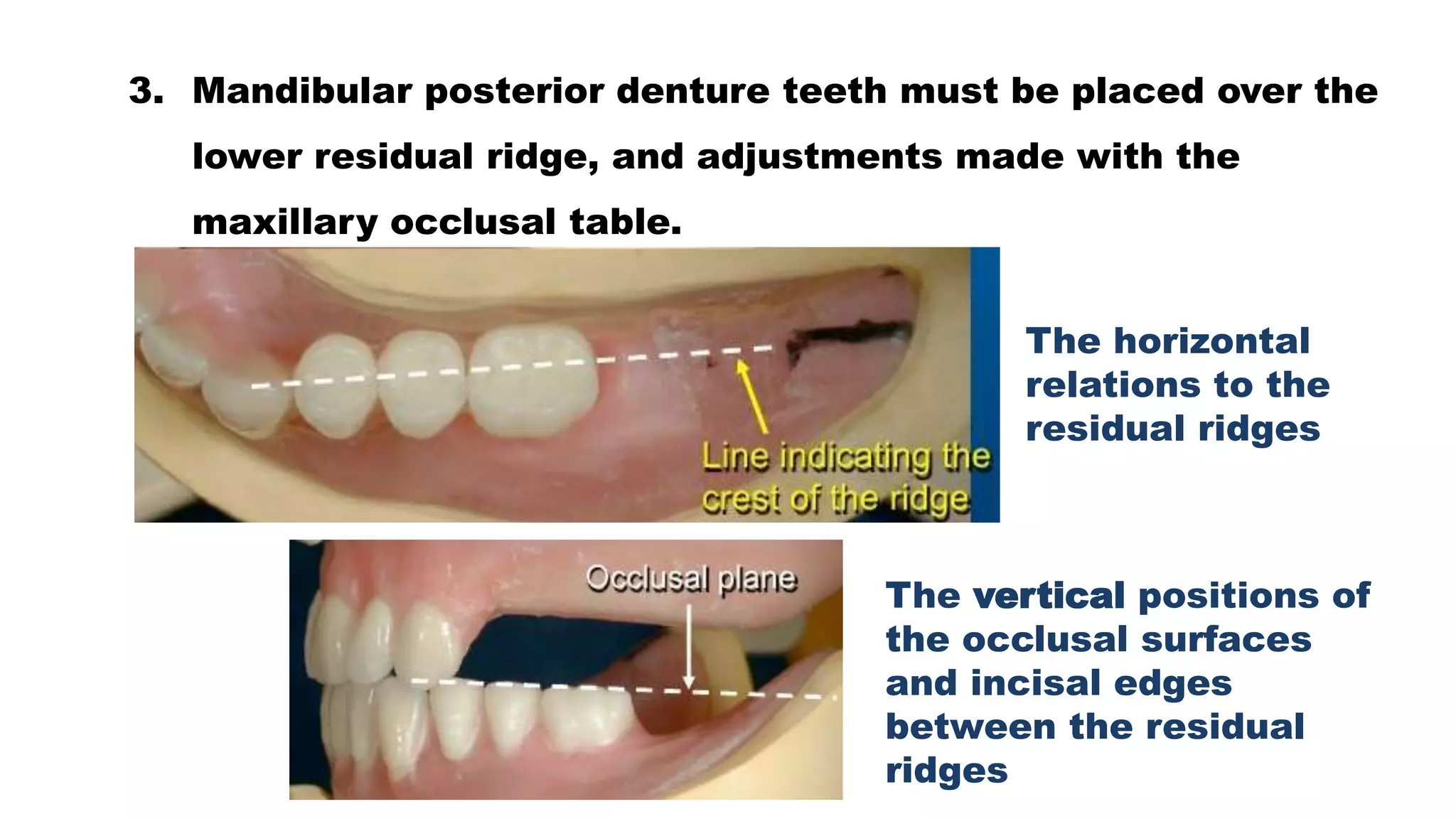 6- Prosthetic Problems and possible solutions in Setting –up of teeth ...