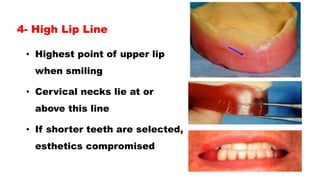 6- Prosthetic Problems and possible solutions in Setting –up of teeth ...