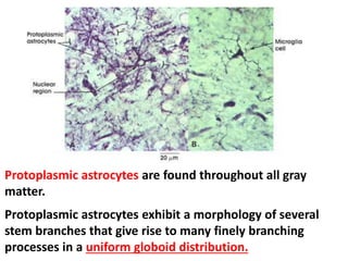 Protoplasmic Astrocytoma: Definition, Molecular Pathogenesis and New ...