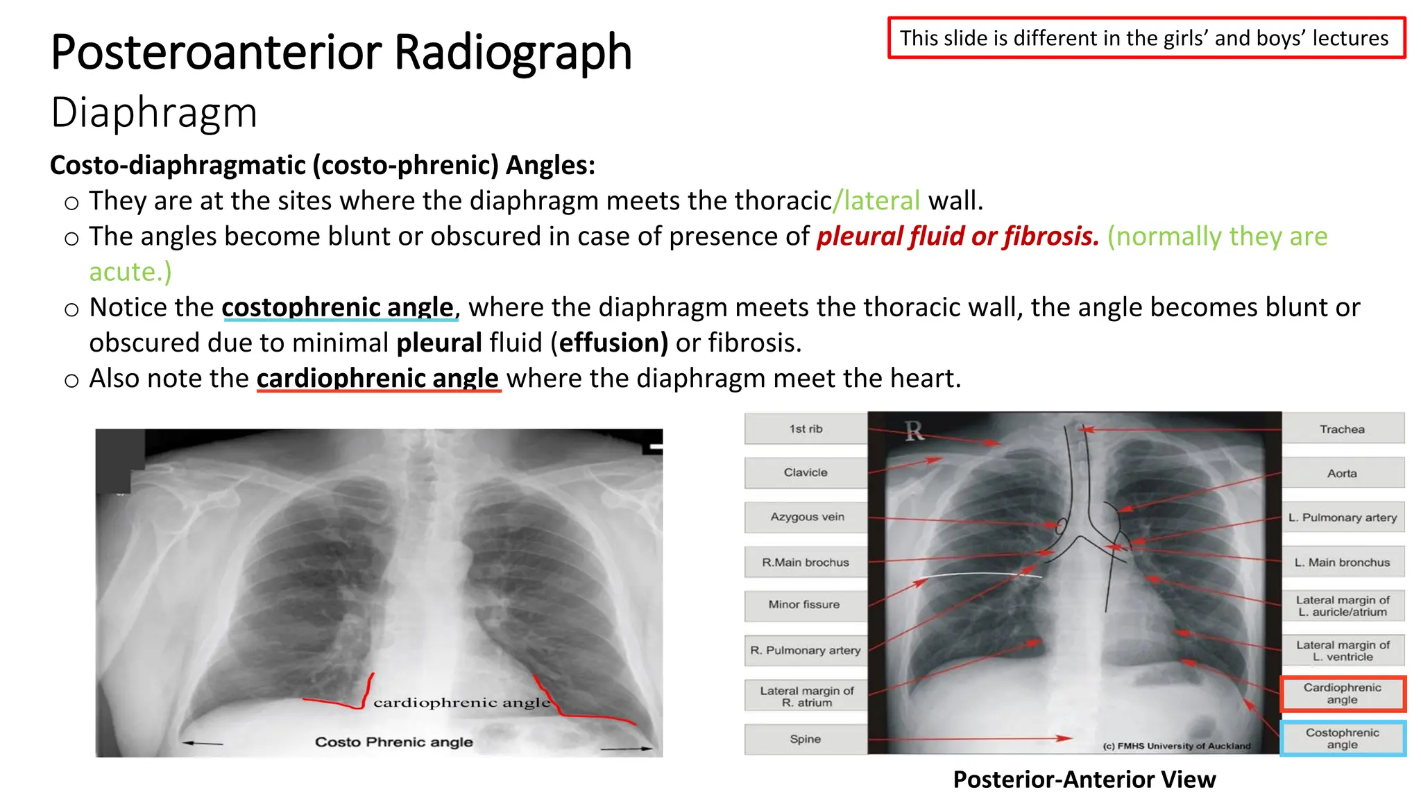 6-Radiological Anatomy Of The Chest..pdf