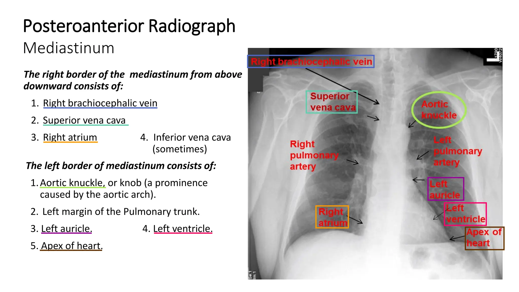6-Radiological Anatomy Of The Chest..pdf