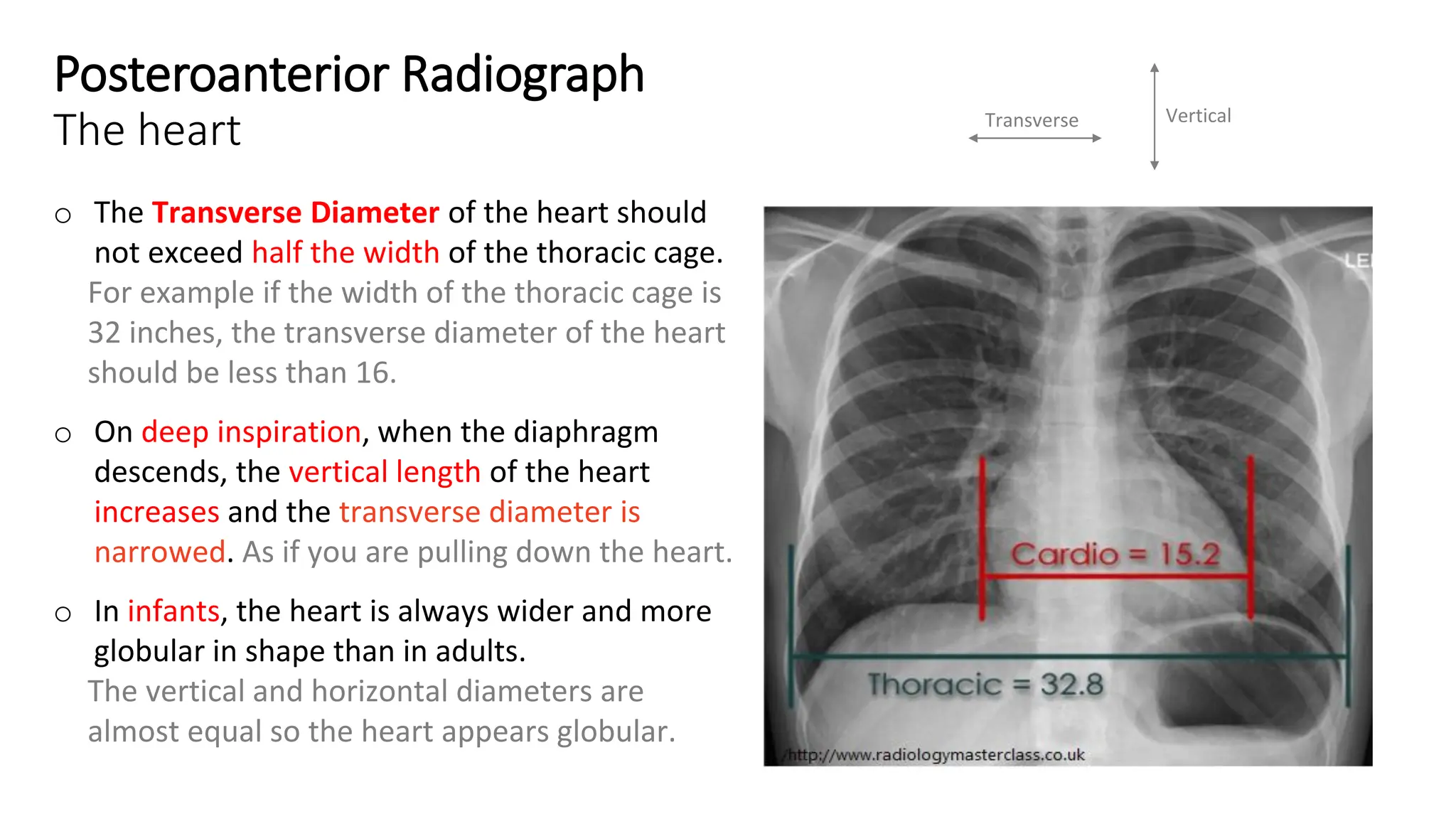 6-Radiological Anatomy Of The Chest..pdf