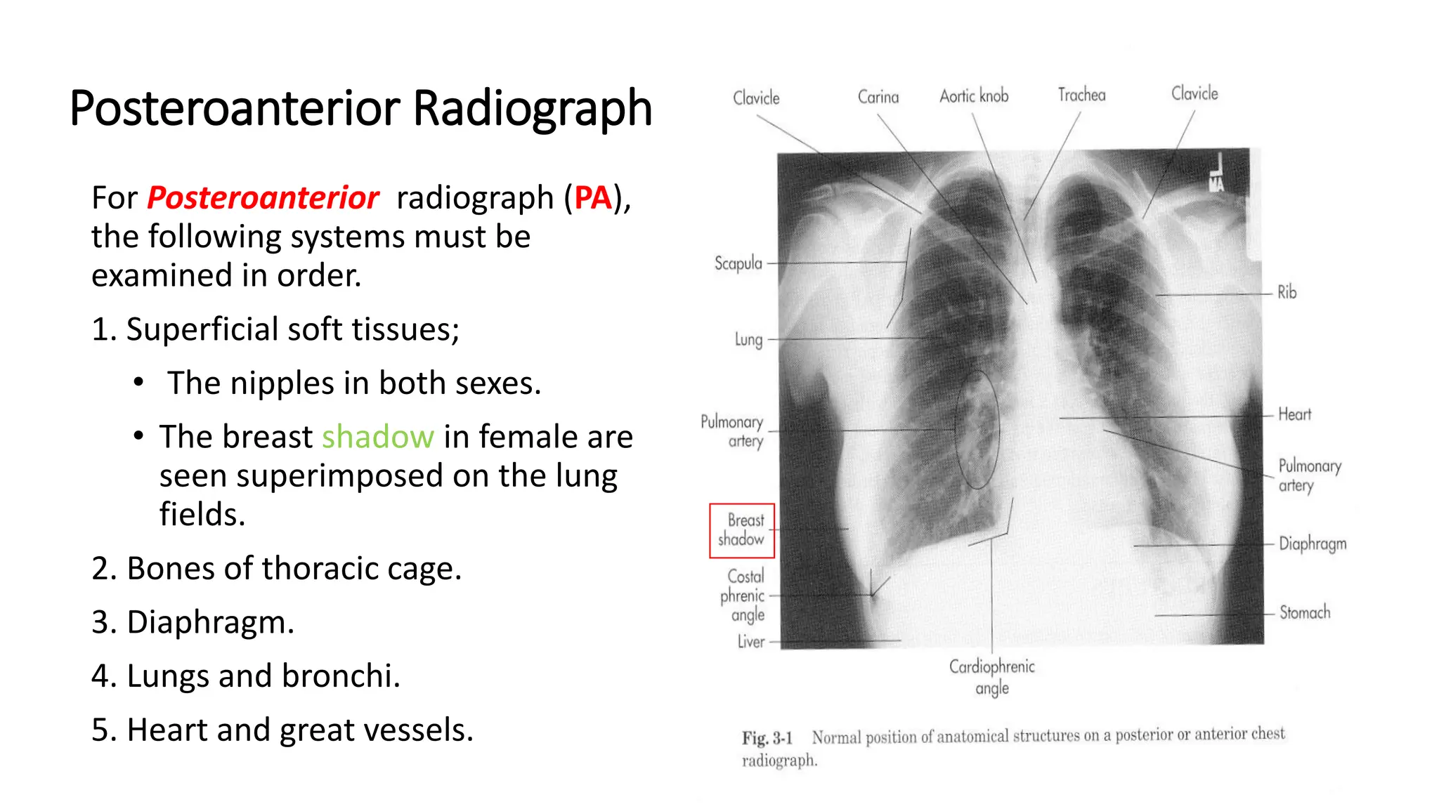 6-Radiological Anatomy Of The Chest..pdf
