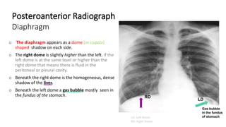 6-Radiological Anatomy Of The Chest..pdf