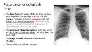 6-Radiological Anatomy Of The Chest..pdf