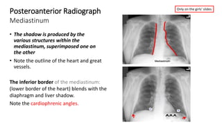 6-Radiological Anatomy Of The Chest..pdf