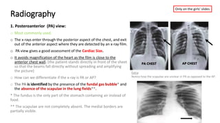 6-Radiological Anatomy Of The Chest..pdf