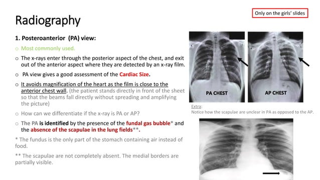 6-Radiological Anatomy Of The Chest..pdf