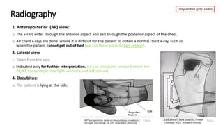 6-Radiological Anatomy Of The Chest..pdf