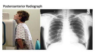 6-Radiological Anatomy Of The Chest..pdf