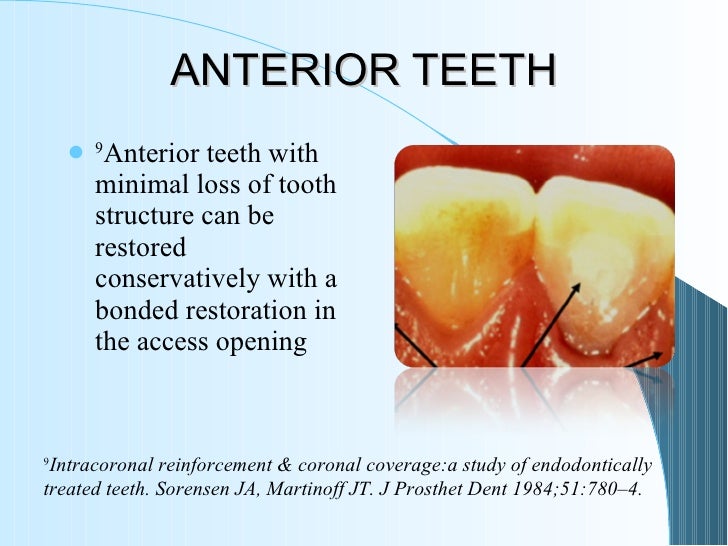 6.restoration of the endodontically treated tooth