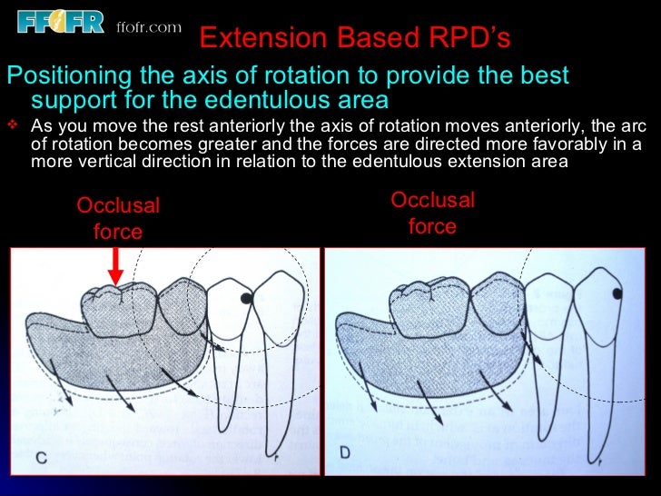 6.rpd design philosophies