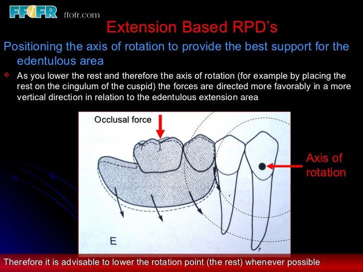 6.rpd design philosophies
