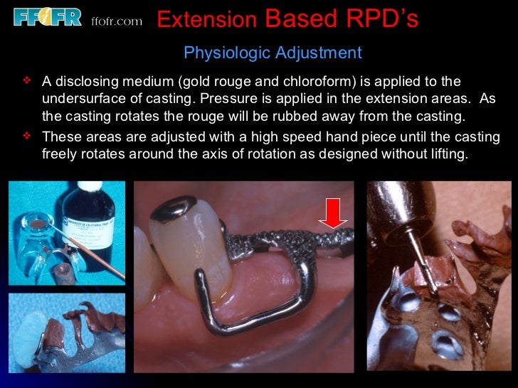 6.rpd design philosophies