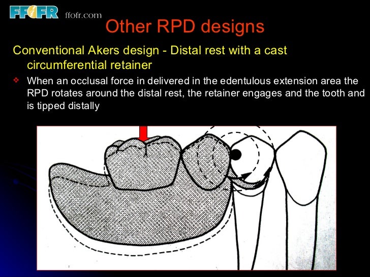 6.rpd design philosophies