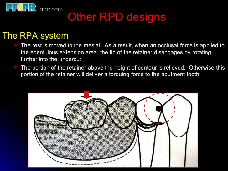 6.rpd design philosophies