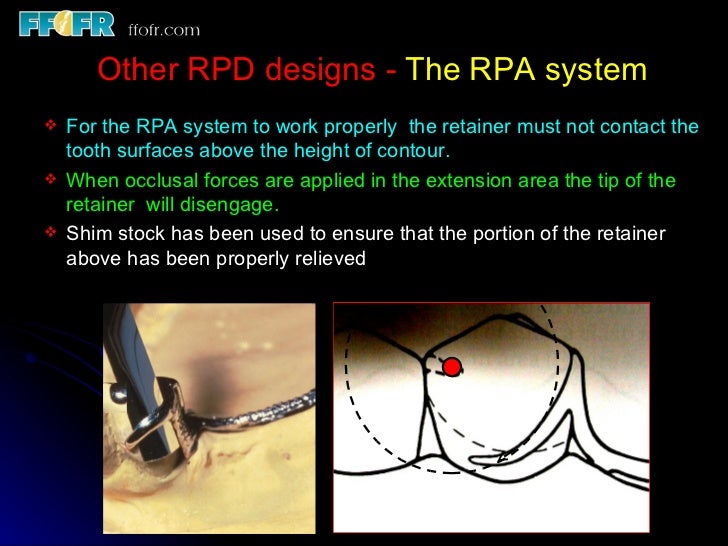 6.rpd design philosophies