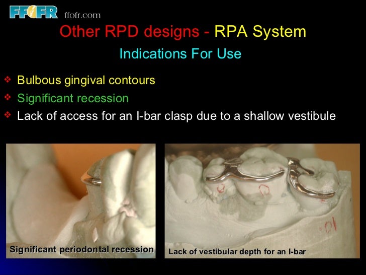 6.rpd design philosophies