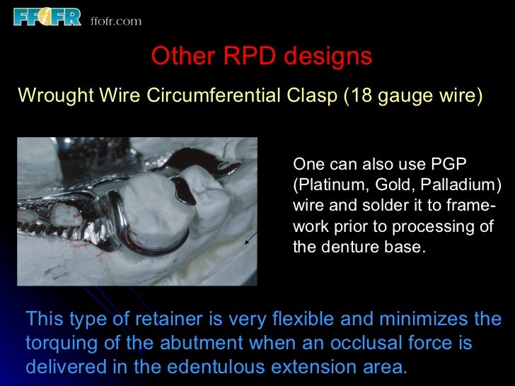 6.rpd design philosophies