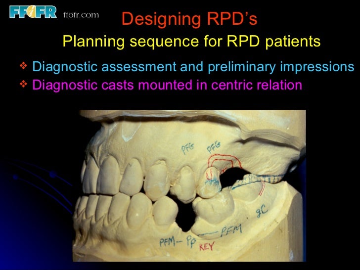 6.rpd design philosophies