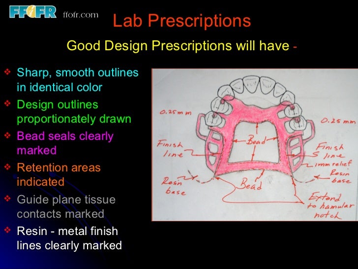 6.rpd design philosophies