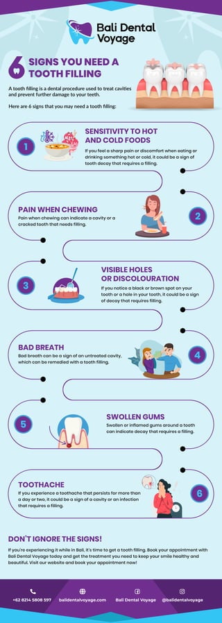 6 Signs You Need a Tooth Filling | PDF