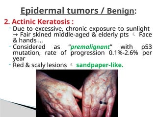 6-Skin tumors(benign and Malignant).pptx