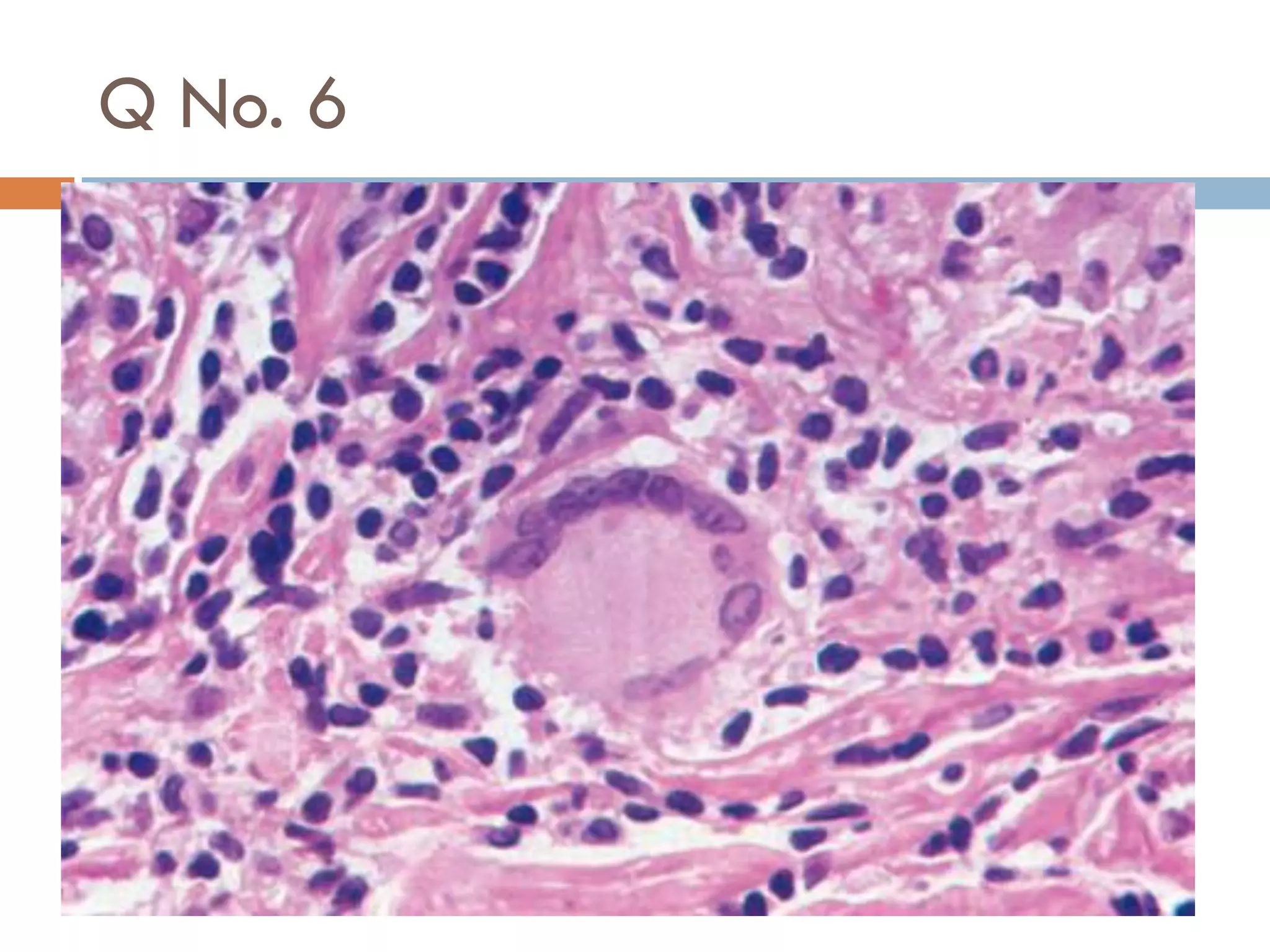 6. stem cells+regeneration dr ashutosh kumar | PPT