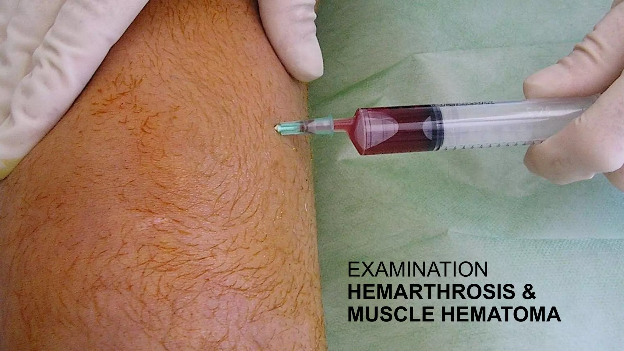 6 surgical hemostasis | PPTX