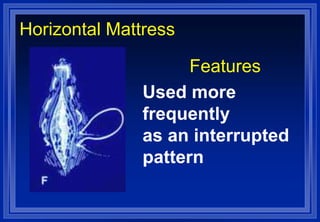SUTURE PATTERNS.ppt