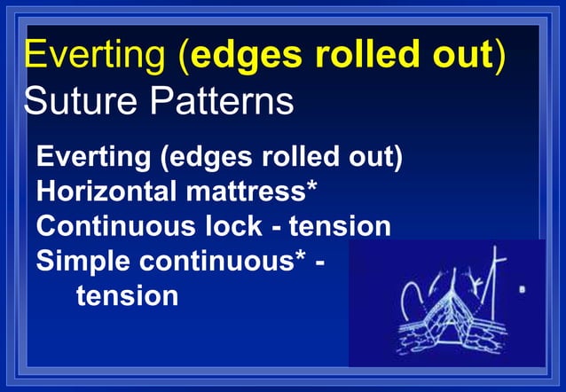 SUTURE PATTERNS.ppt