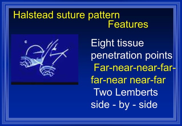 SUTURE PATTERNS.ppt