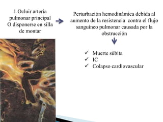 Tromboembolismo pulmonar | PPTX