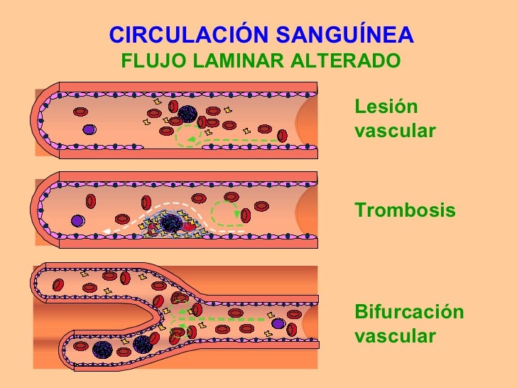 TROMBOSIS